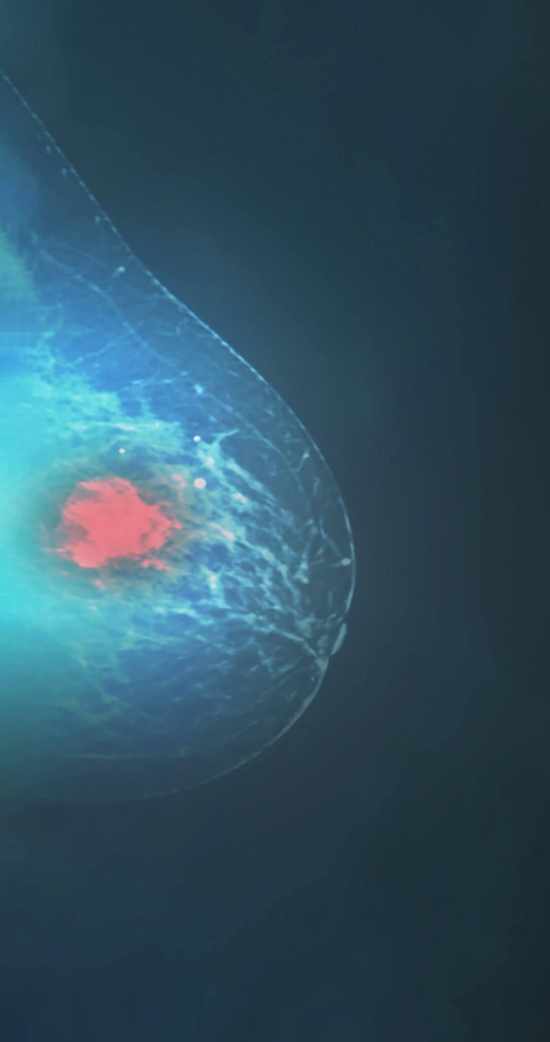 Vayyar Imaging LTD - 世界最先端の4Dイメージセンサー